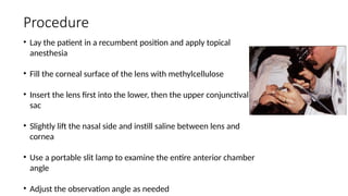 Anterior Segment Evaluation Techniques.pptx