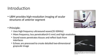 Anterior Segment Evaluation Techniques.pptx