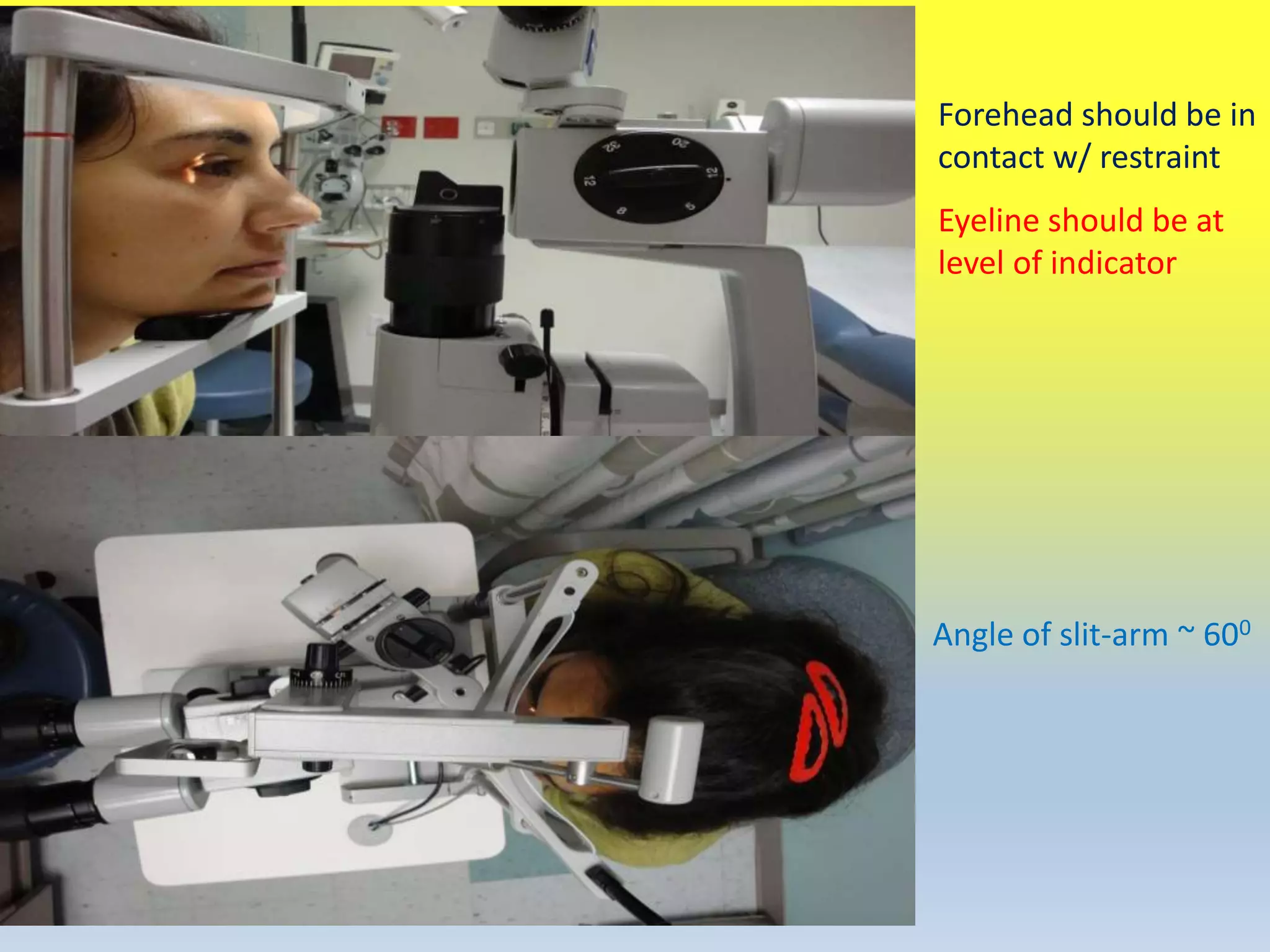 Anterior segment examination | PPTX