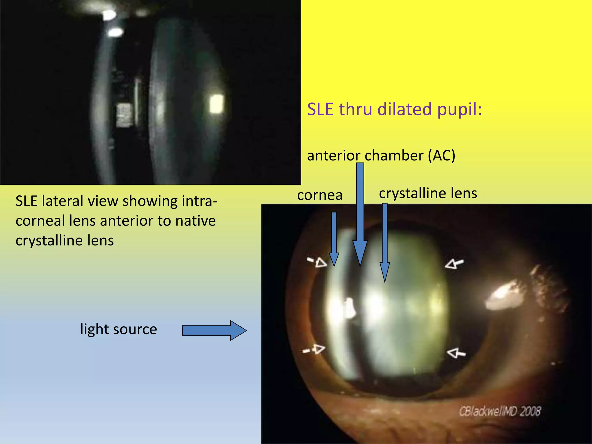 Anterior segment examination | PPTX