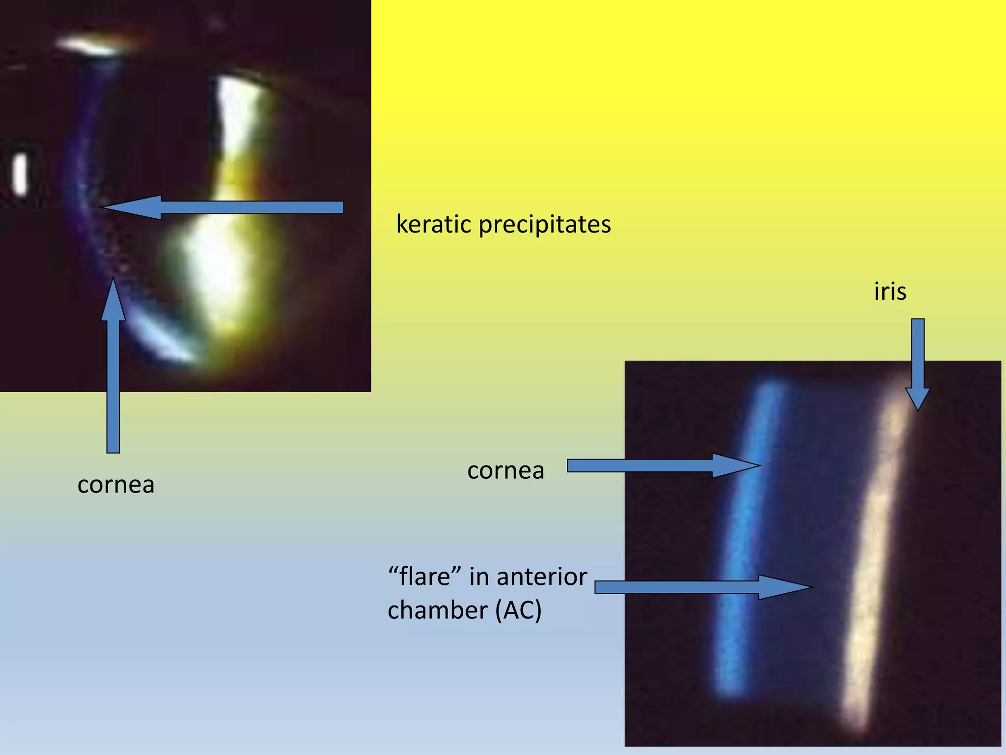 Anterior segment examination | PPTX