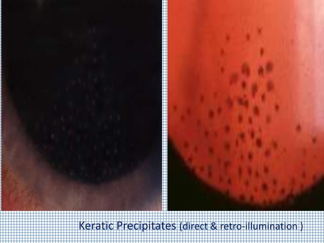 Anterior segment examination | PPTX