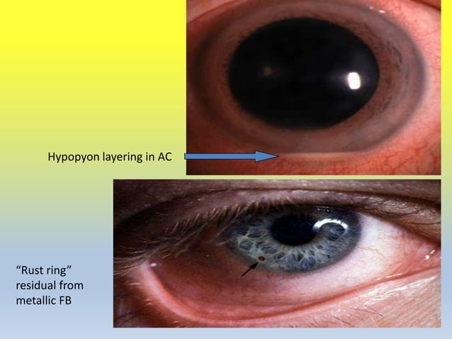 Anterior segment examination | PPTX