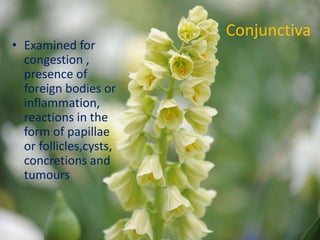 Anterior segment examination | PPTX