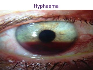 Anterior segment examination | PPTX