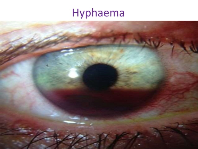 Anterior segment examination | PPTX