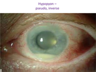 Anterior segment examination | PPTX