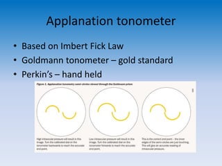 Anterior segment examination | PPTX