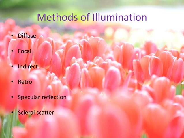Anterior segment examination | PPTX
