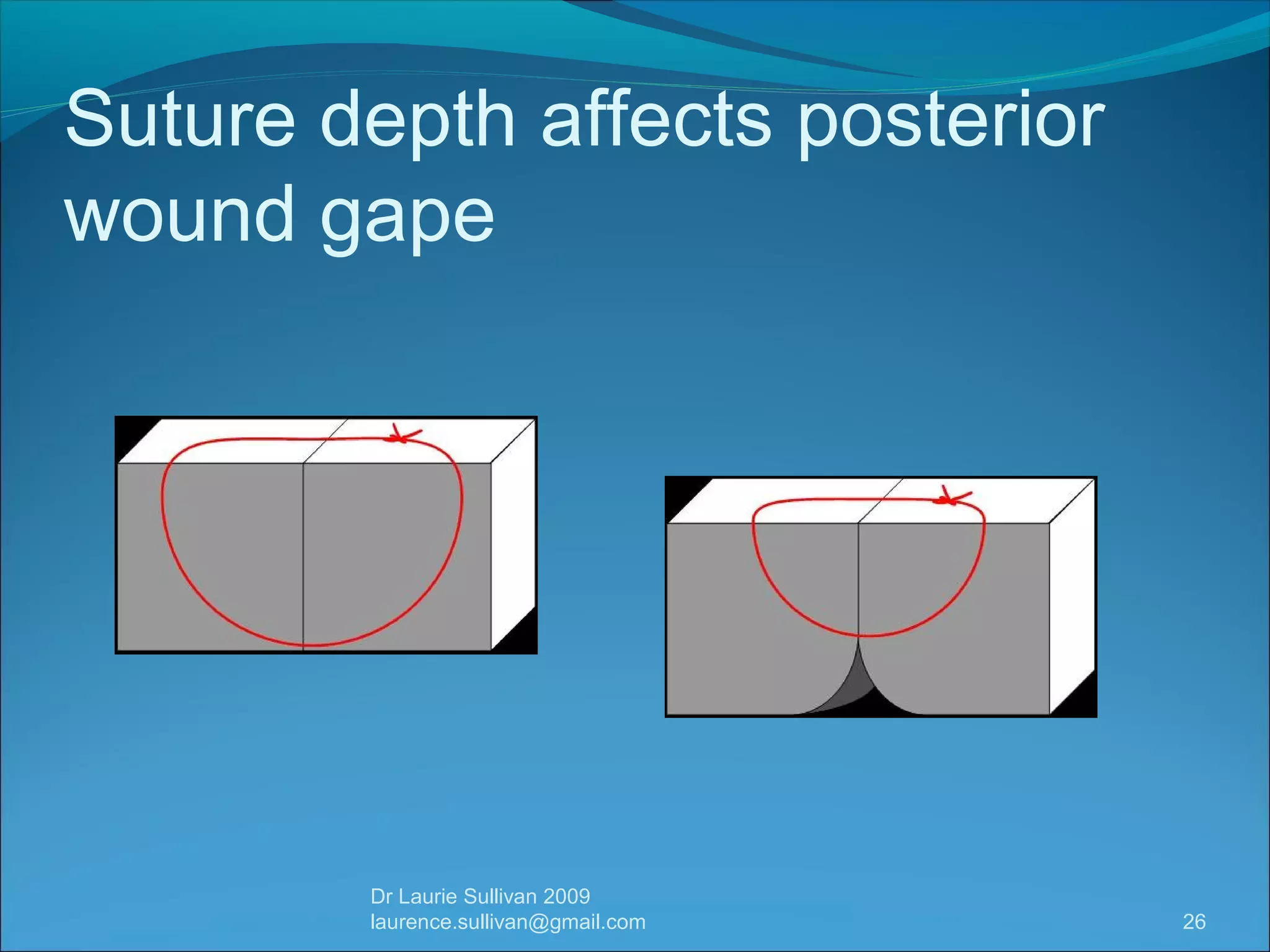 Anterior segment trauma ranzco 11112009 | PPT