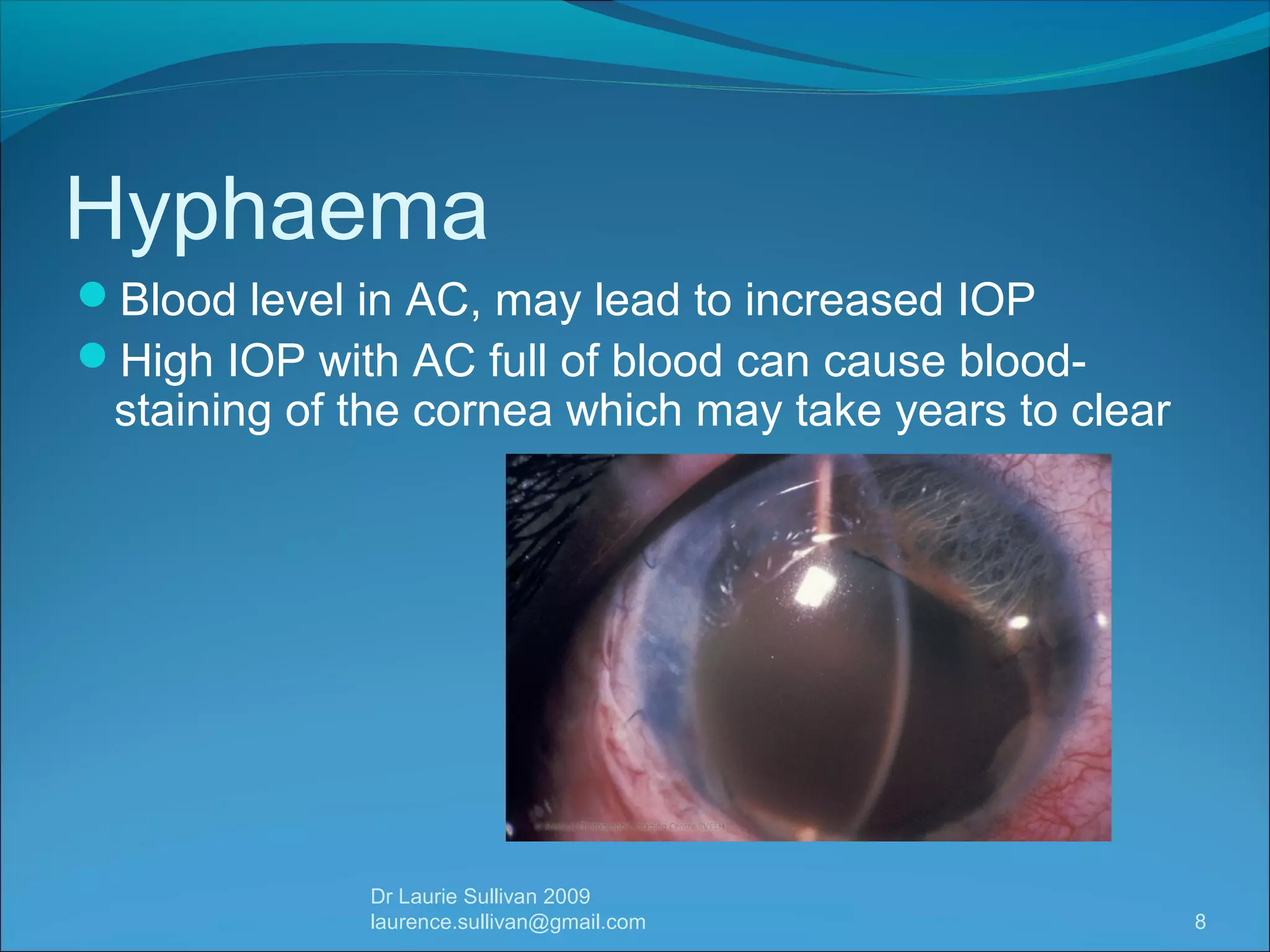 Anterior segment trauma ranzco 11112009 | PPT