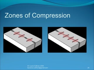 Anterior segment trauma ranzco 11112009 | PPT