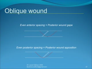 Anterior segment trauma ranzco 11112009 | PPT