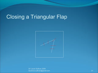 Anterior segment trauma ranzco 11112009 | PPT