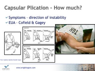 Anterior shoulder instability st4-6 | PDF | Death, Injury, or Military ...