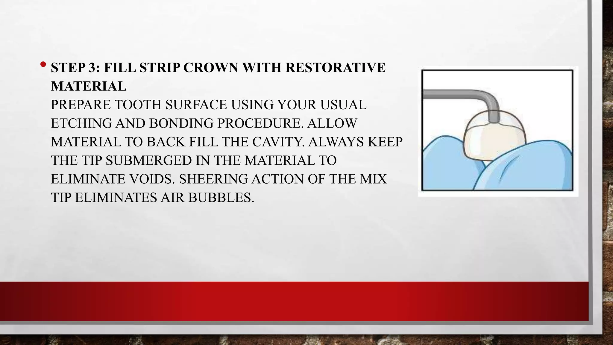 Anterior strip crown | PPTX