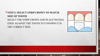 Anterior strip crown | PPTX
