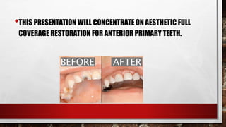 Anterior strip crown | PPTX