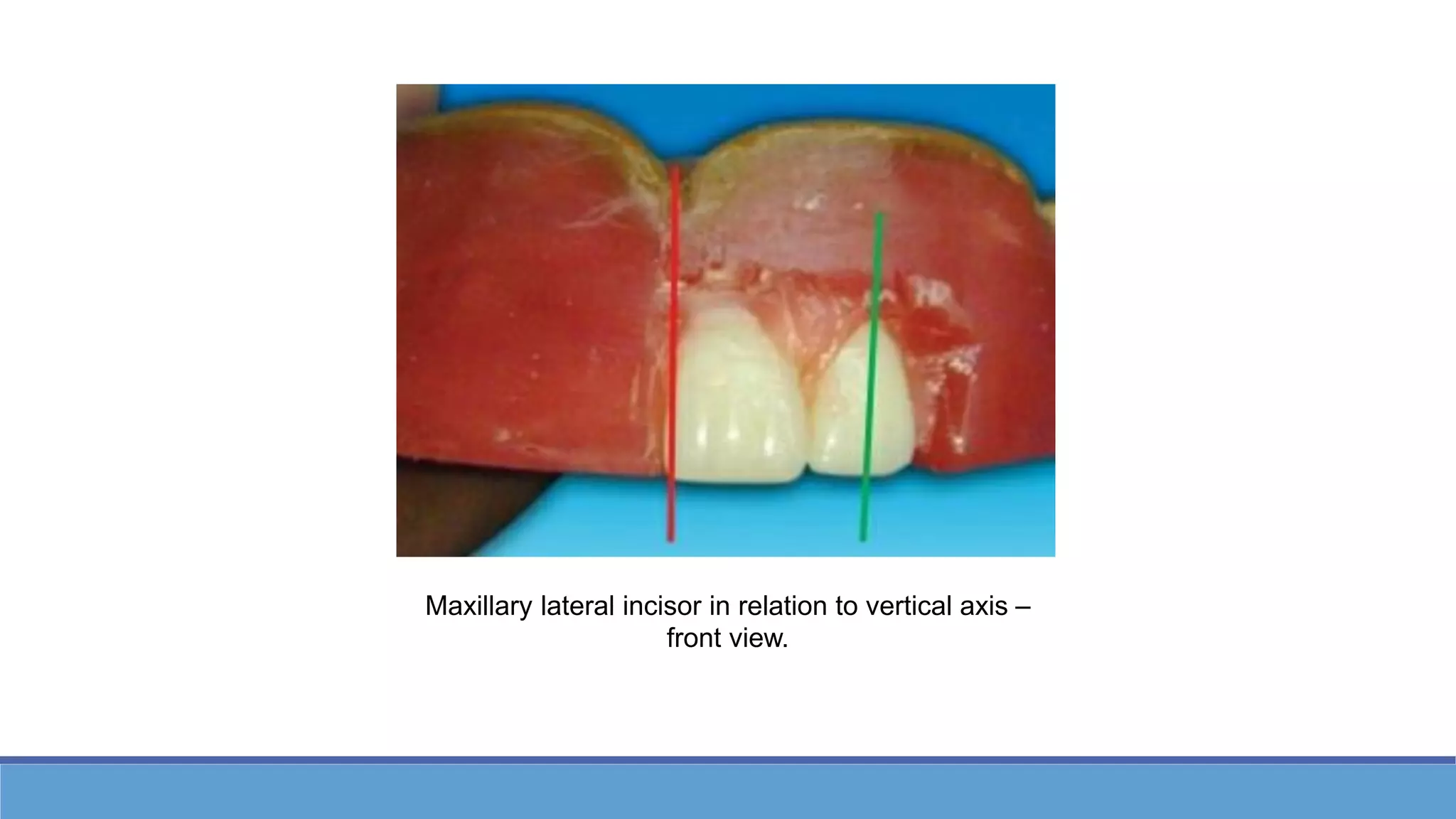 Anterior Teeth Arrangement | PDF