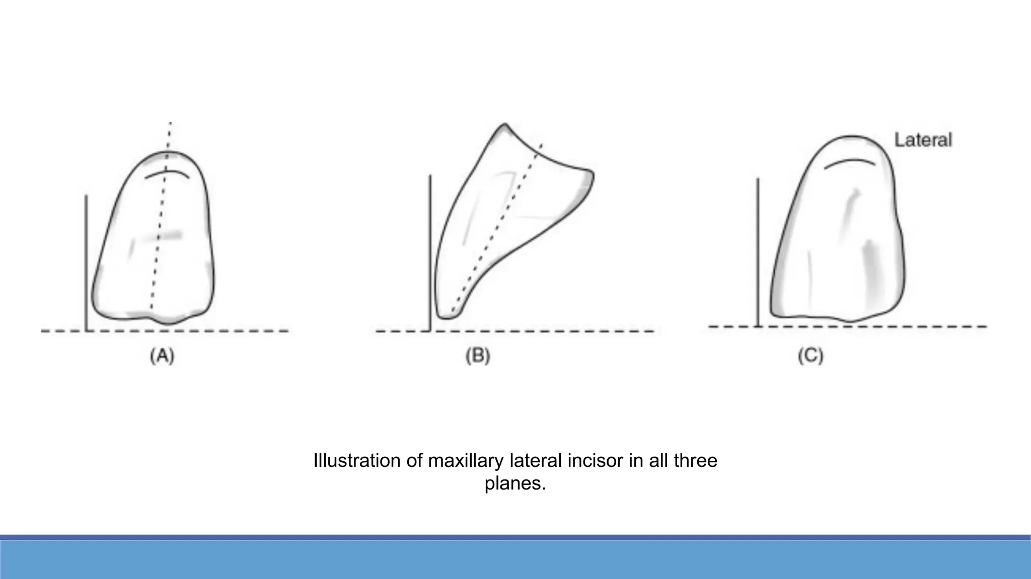 Anterior Teeth Arrangement | PDF