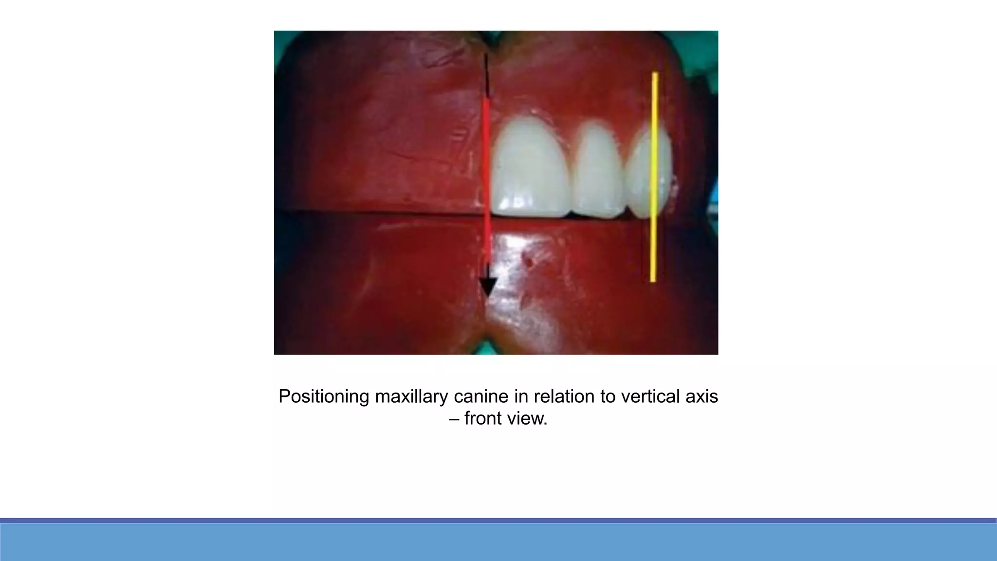 Anterior Teeth Arrangement | PDF