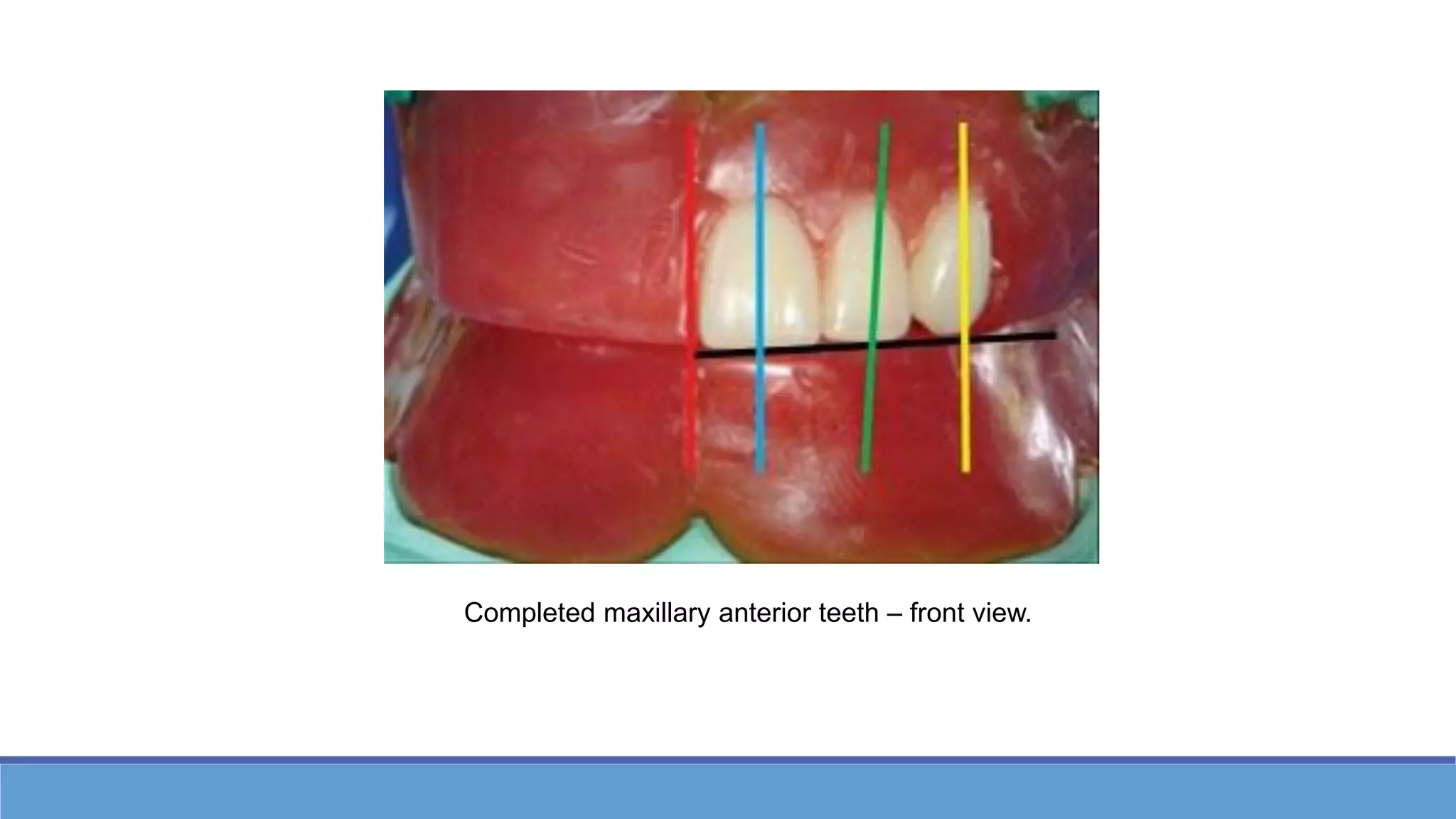 Anterior Teeth Arrangement | PDF
