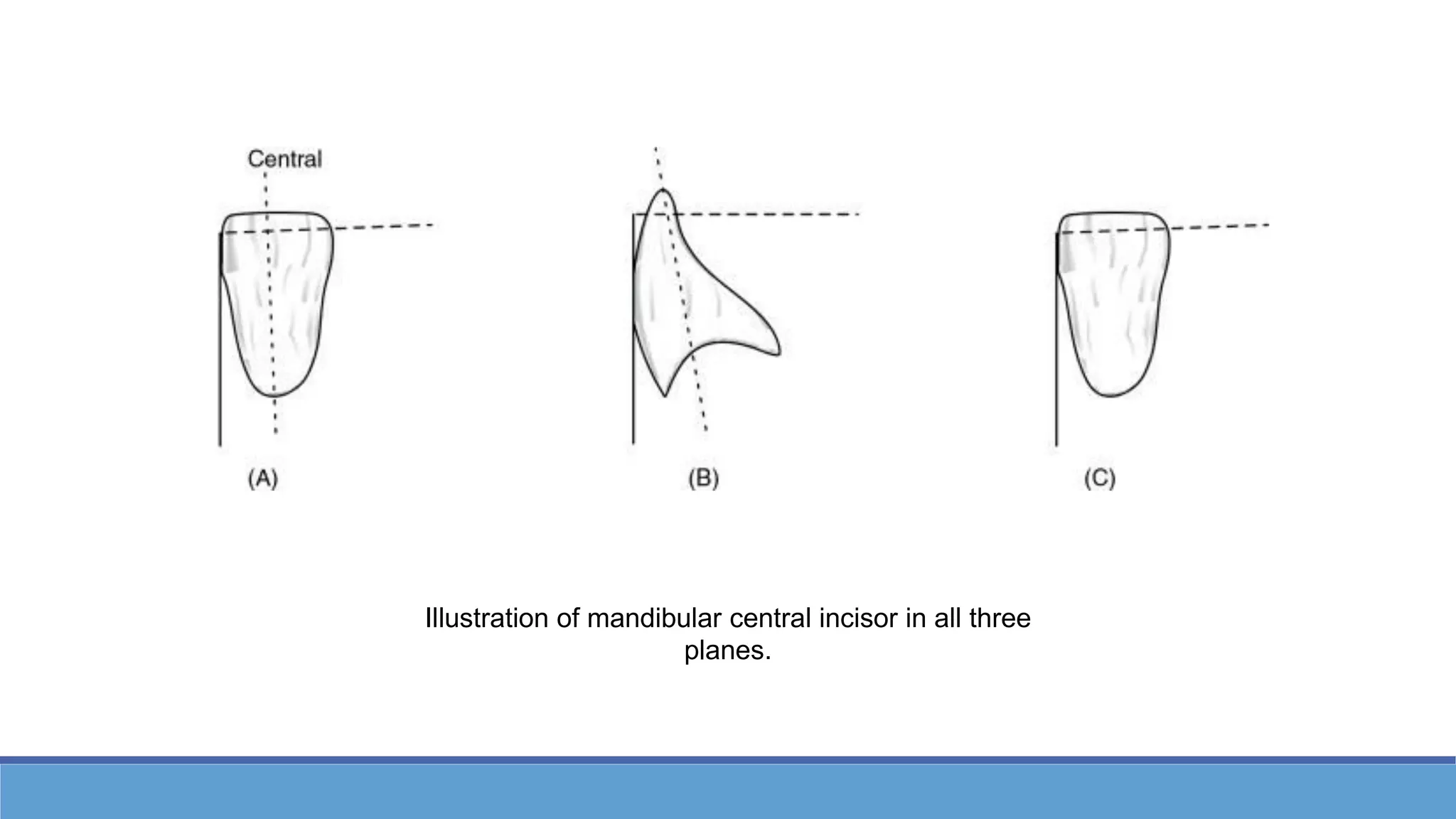 Anterior Teeth Arrangement | PDF