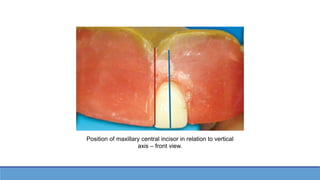 Anterior Teeth Arrangement | PDF