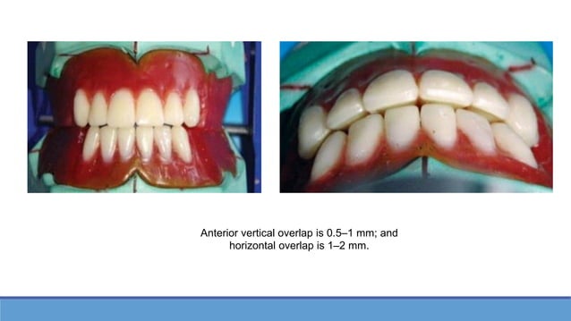 Anterior Teeth Arrangement | PPT
