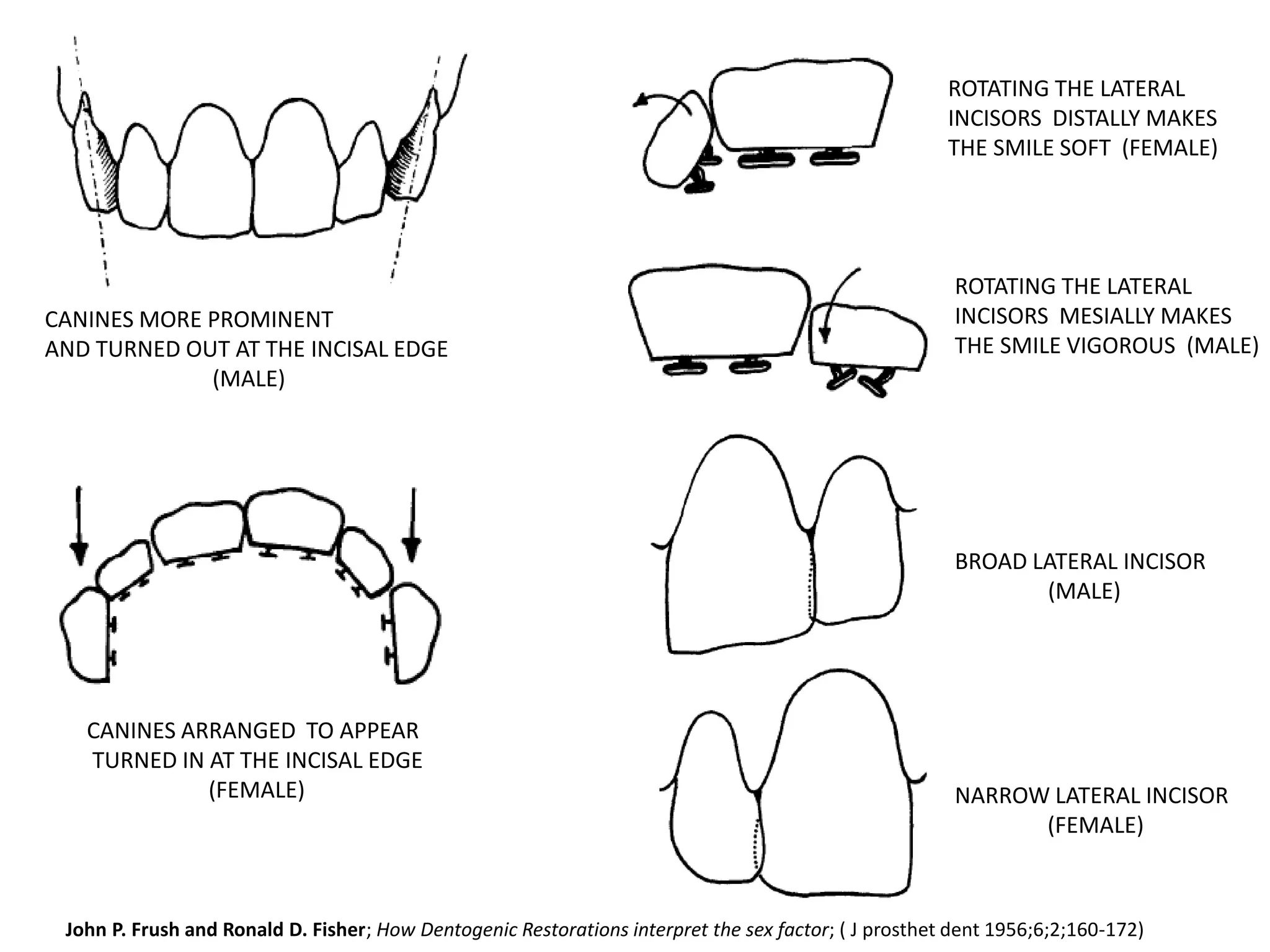 Anterior teeth selection | PPTX