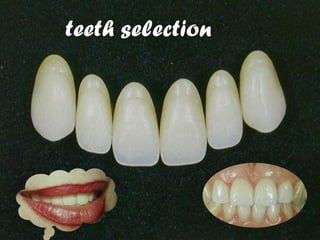 Anterior teeth selection.in complete denture | PPT