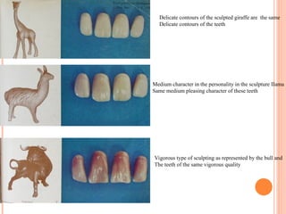 Anterior teeth selection.in complete denture | PPT