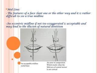 Anterior teeth selection.in complete denture | PPT