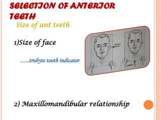 Anterior teeth selection.in complete denture | PPT