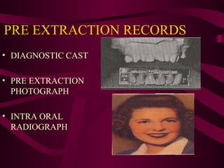 ANTERIOR TEhhkkkkkmkkkkmETH SELECTION.ppt