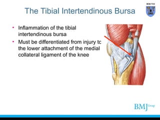 Anatomy of Anterior thigh | PPT