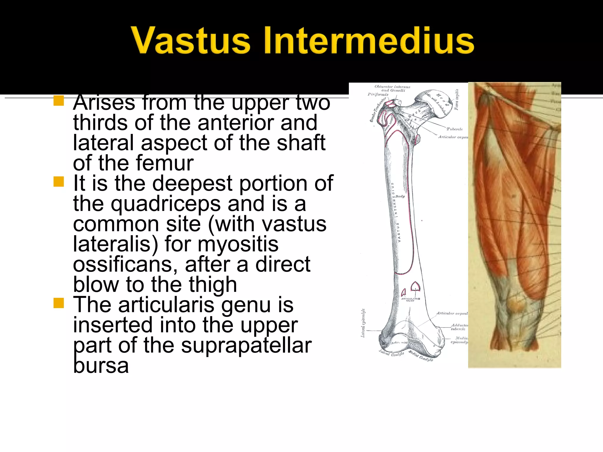Anterior thigh by- dr. armaan singh | PPT