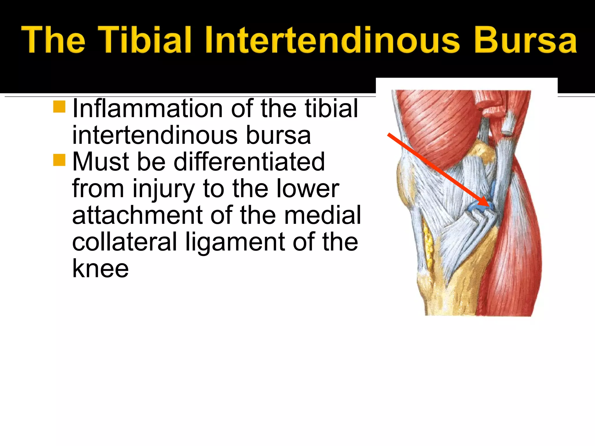 Anterior thigh by- dr. armaan singh | PPT