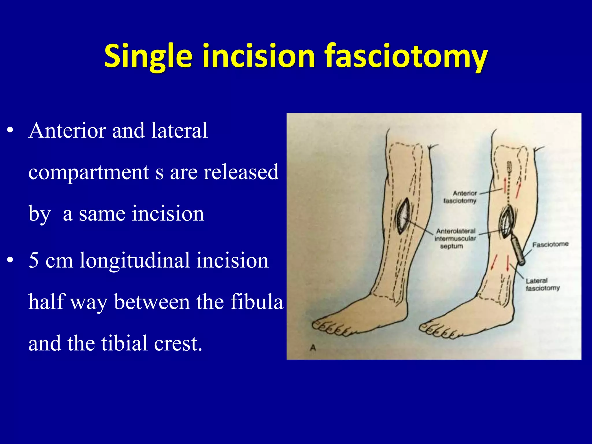 ANTERIOR TIBIAL SYNDROME AND REYNAUD''S DISEASE | PPT