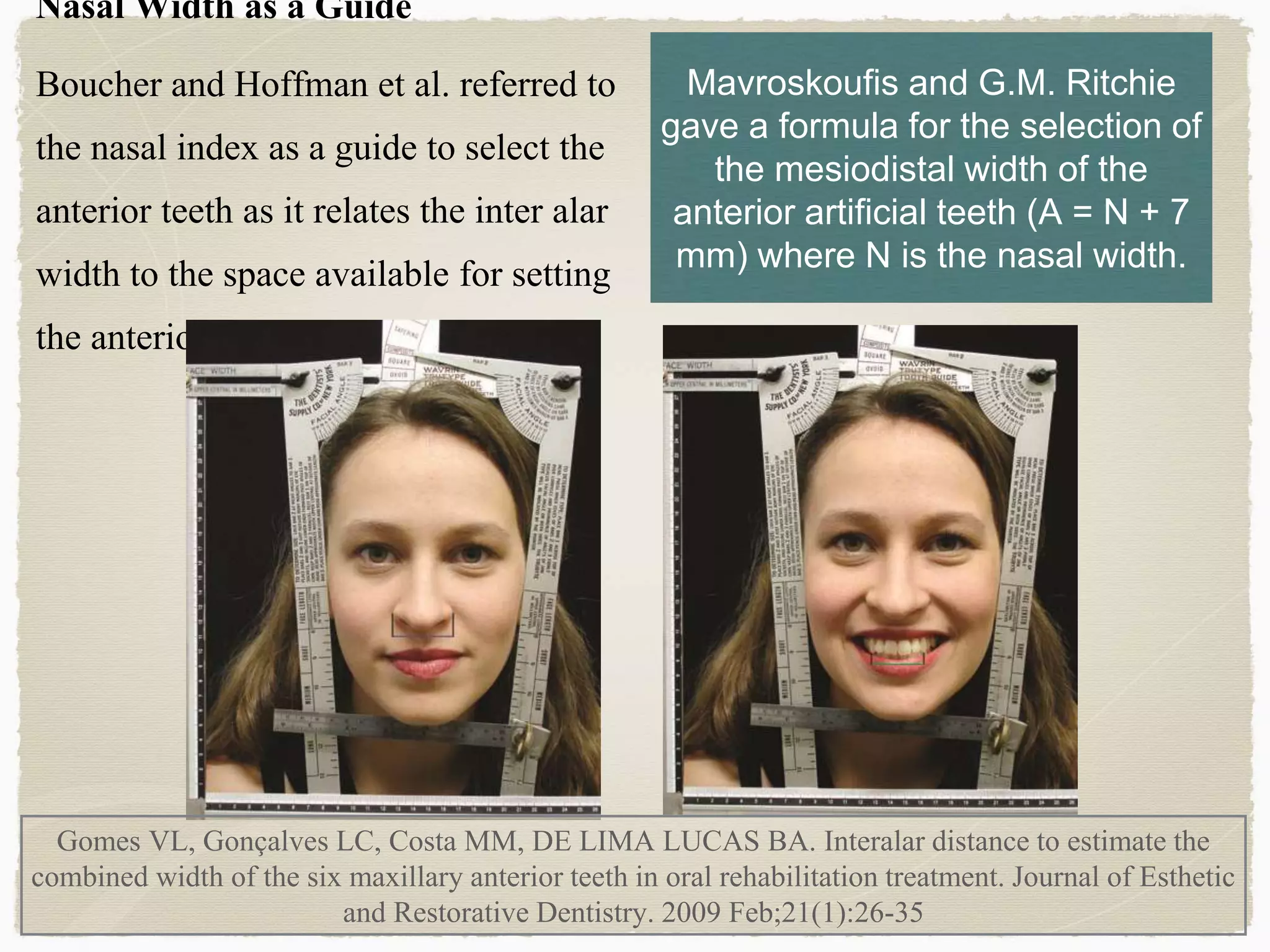 Anterior tooth selection | PPTX