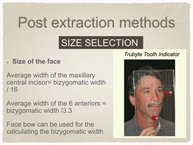 Anterior tooth selection | PPTX