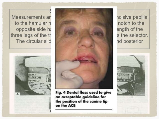 Anterior tooth selection | PPTX