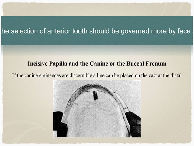 Anterior tooth selection | PPTX