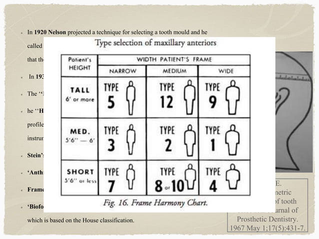 Anterior tooth selection | PPTX