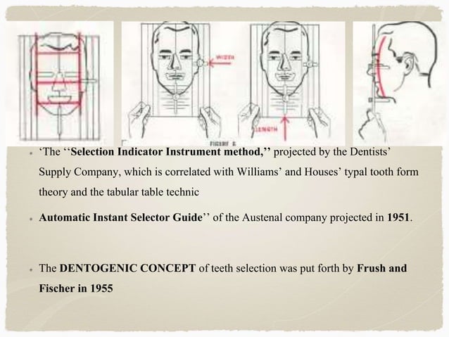 Anterior tooth selection | PPTX