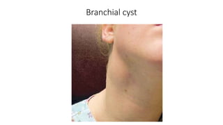 Anterior triangle- subdivisions & Anterior median region structures of ...
