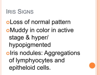 Anterior uveitis | PPTX