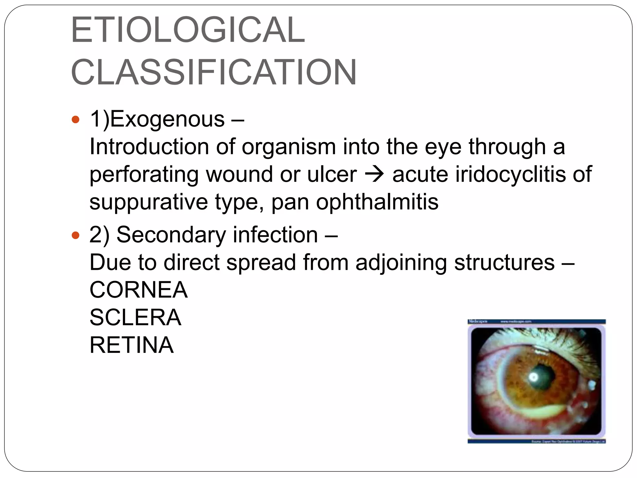 Anterior uveitis | PPTX