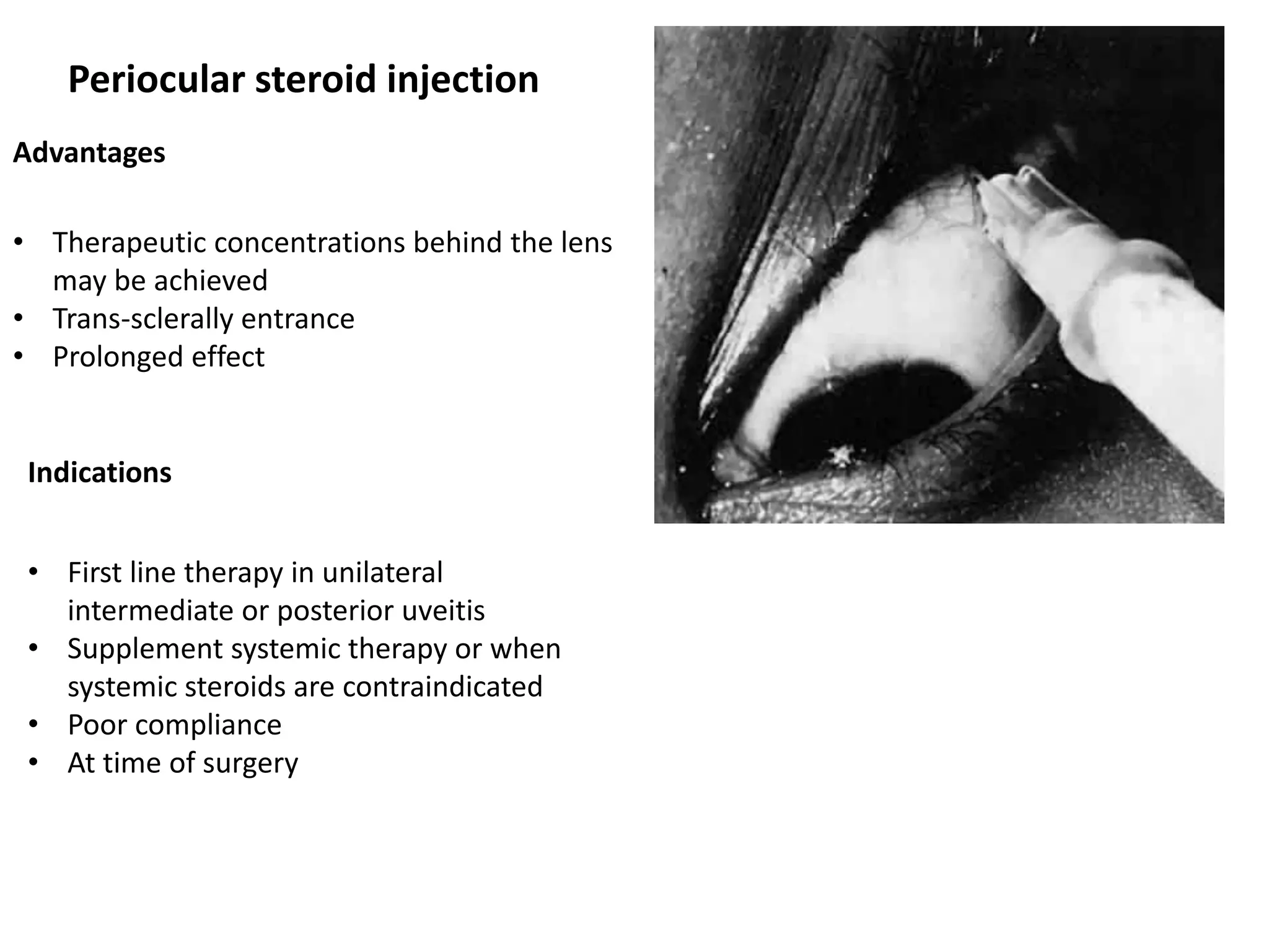 clinical case presentation on anterior uveitis | PPTX