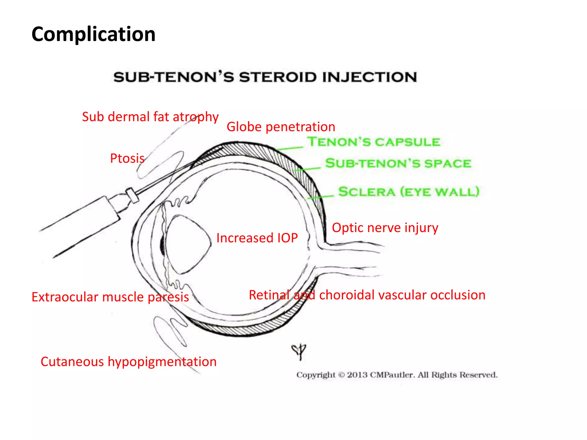 clinical case presentation on anterior uveitis | PPTX
